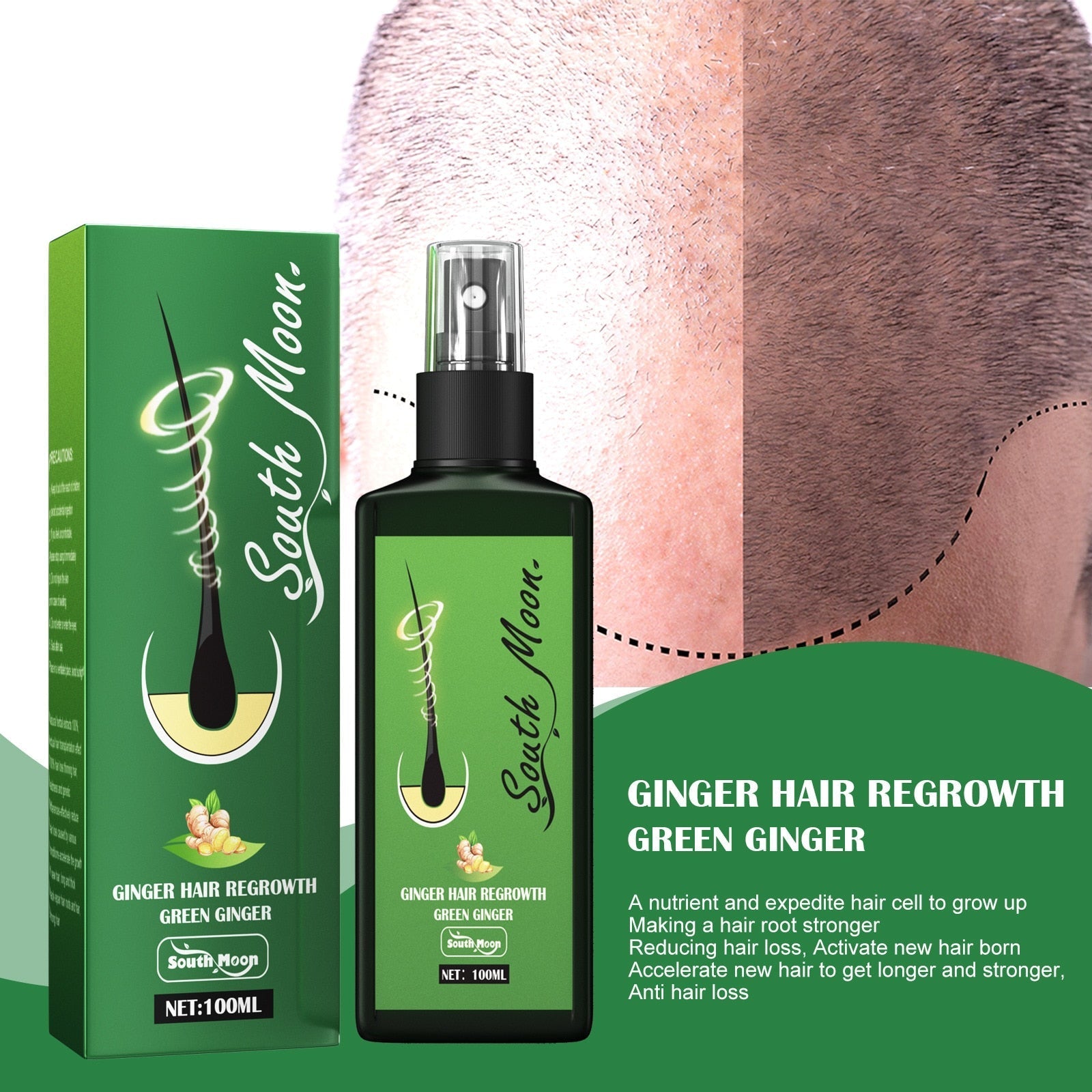 GINGER NOURISHING SPRAY - Hair Growth – Nimebrand