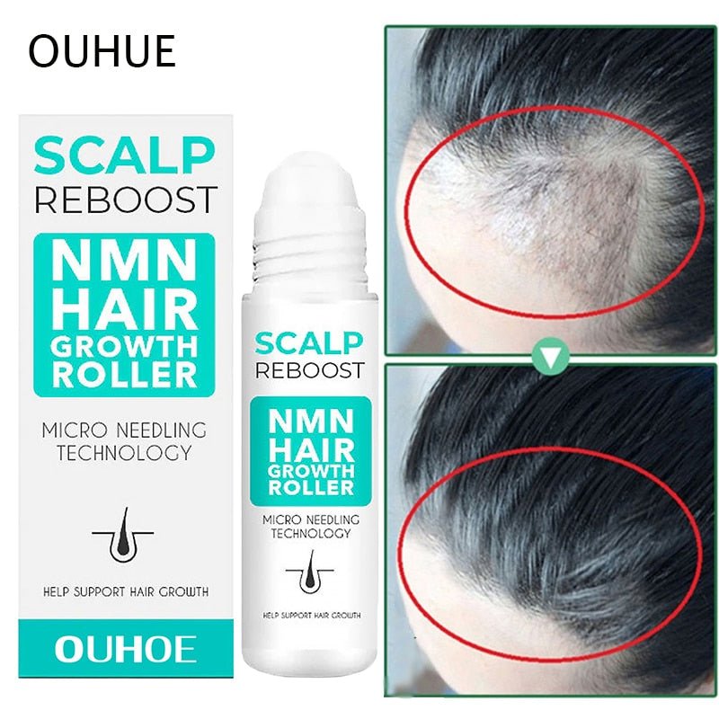 Rapid Hair Growth Serum Roller – Nimebrand