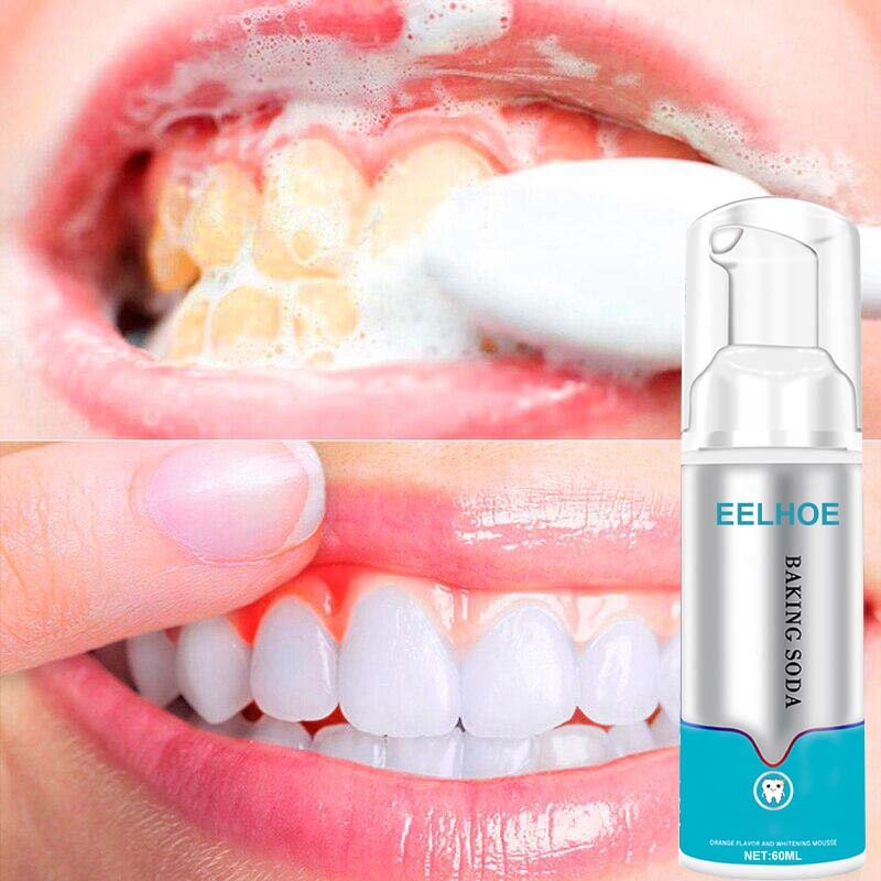 Teeth Whitening Mousse Toothpaste – Nimebrand